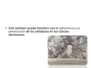 Obturacion en Endodoncia | PPTX