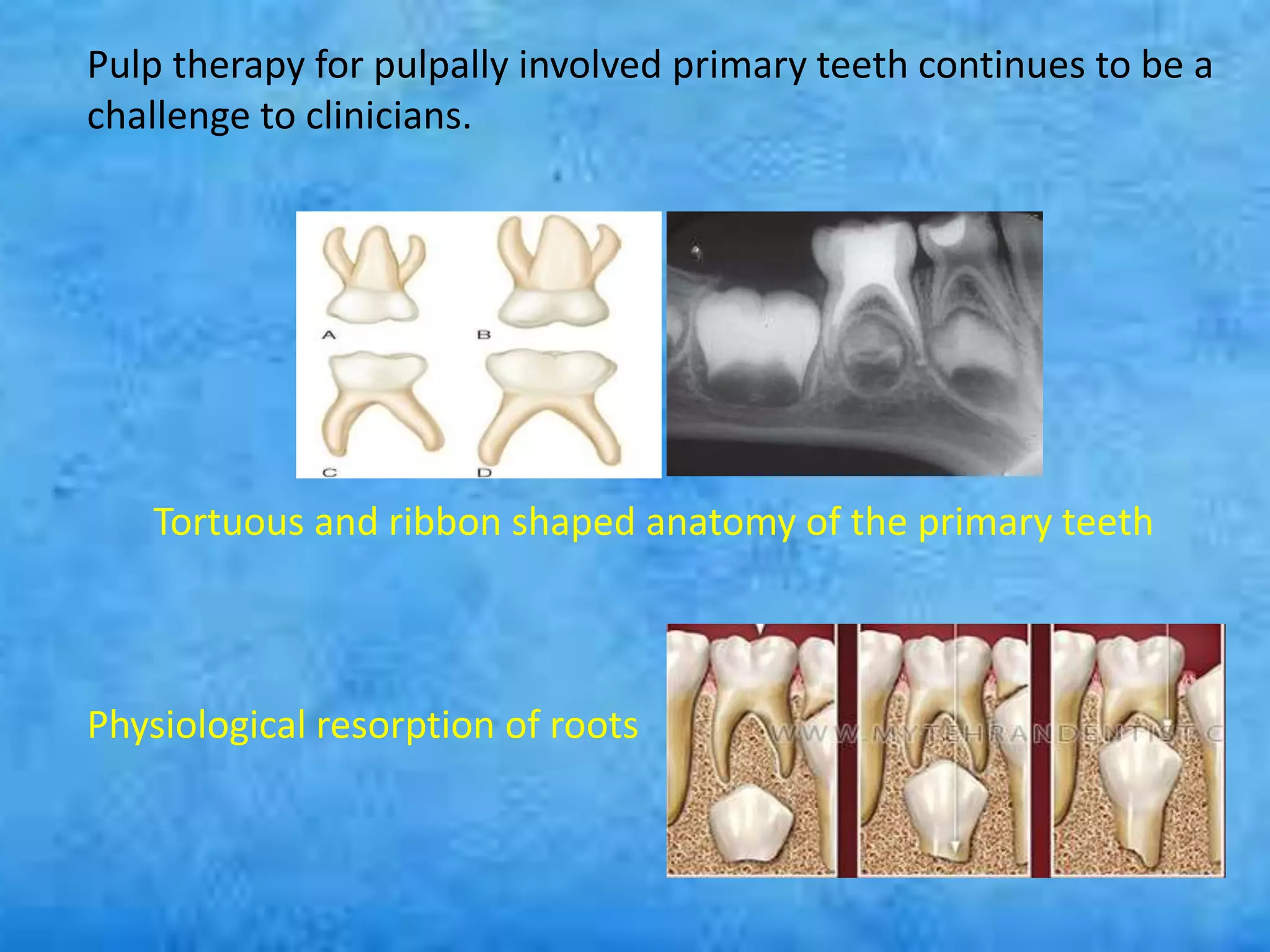 Obturating materials for primary tooth | PPTX