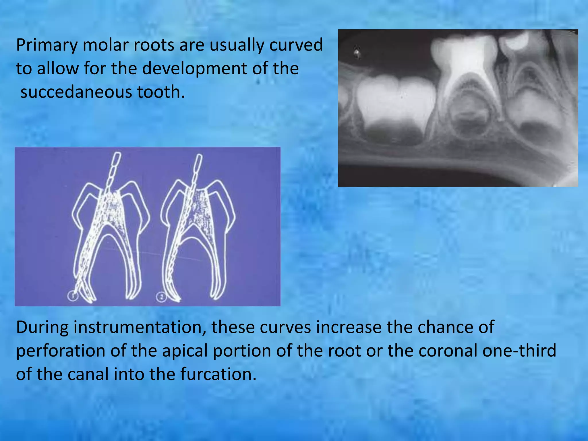 Obturating materials for primary tooth | PPTX