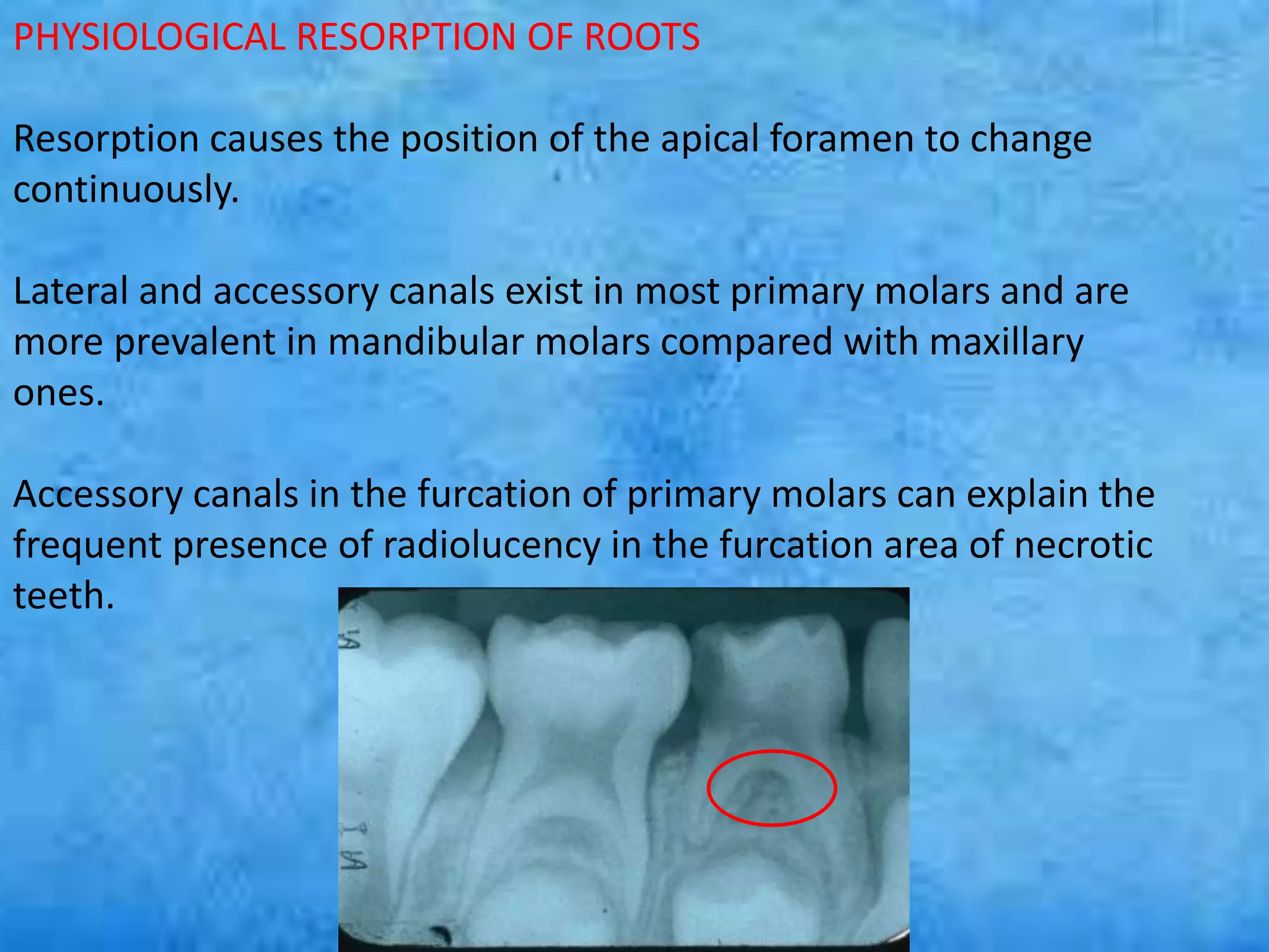 Obturating materials for primary tooth | PPTX