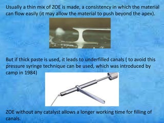 Obturating materials for primary tooth | PPTX