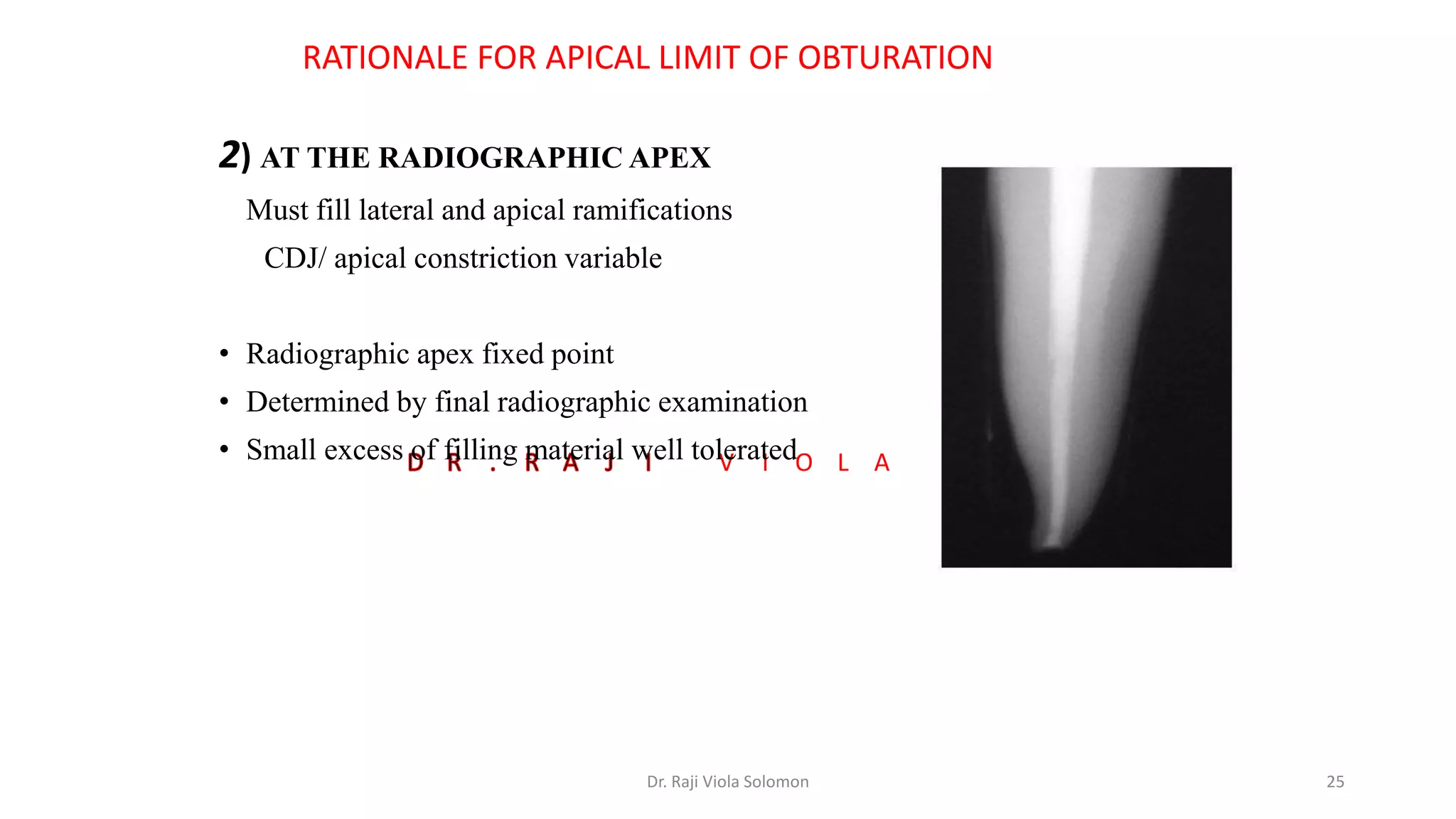 Obturation.of.the.Root.Canal.Space.Part1 | PDF