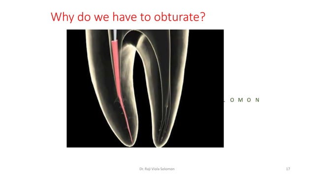 Obturation.of.the.Root.Canal.Space.Part1 | PPT
