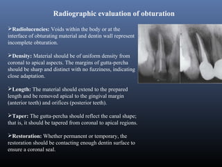 Obturation dr gaurav garg- 17-11-2013 & 24-11-13 | PPT