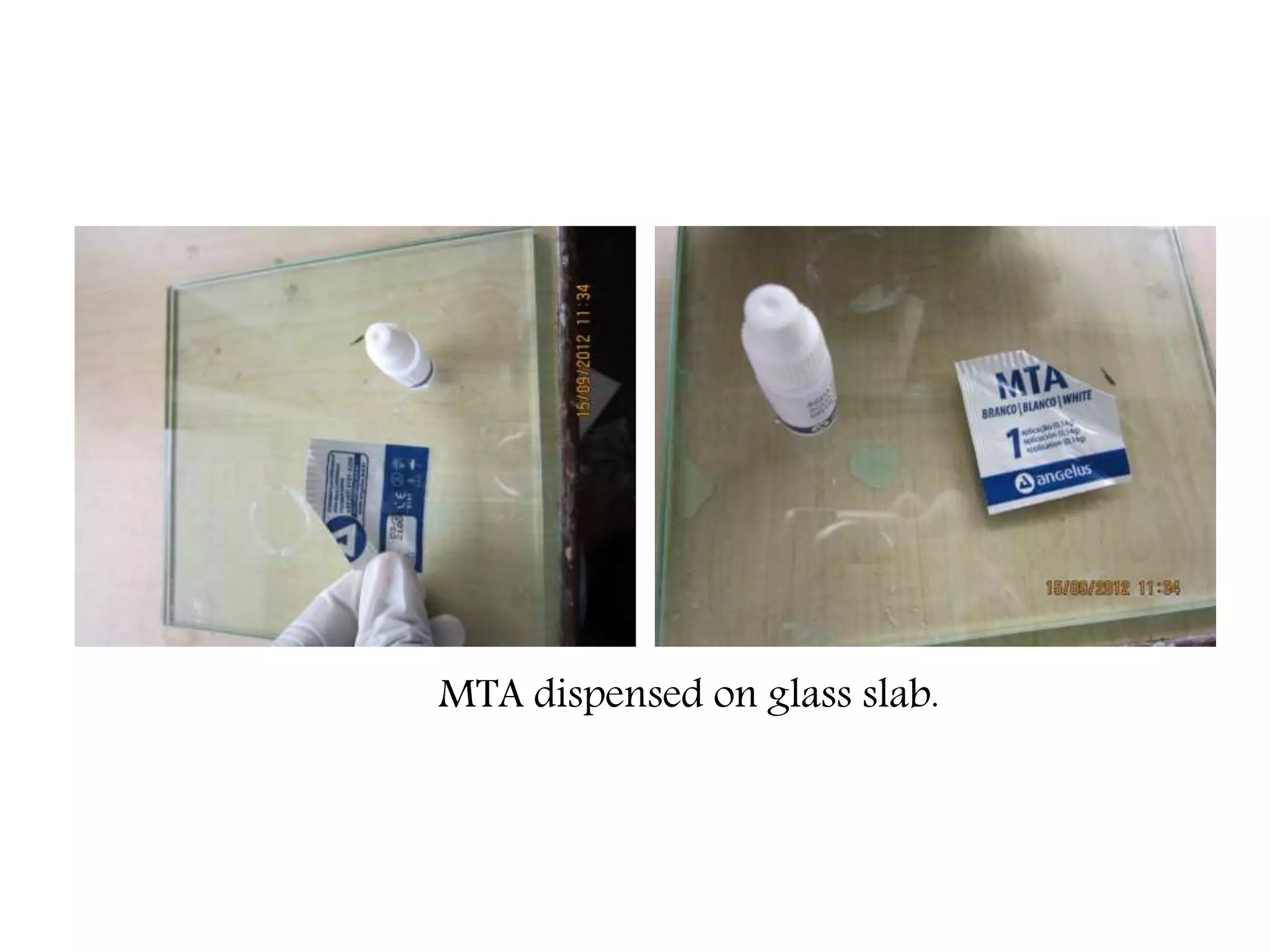 Obturation by mta | PPTX