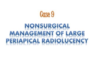 Obturation by mta | PPTX