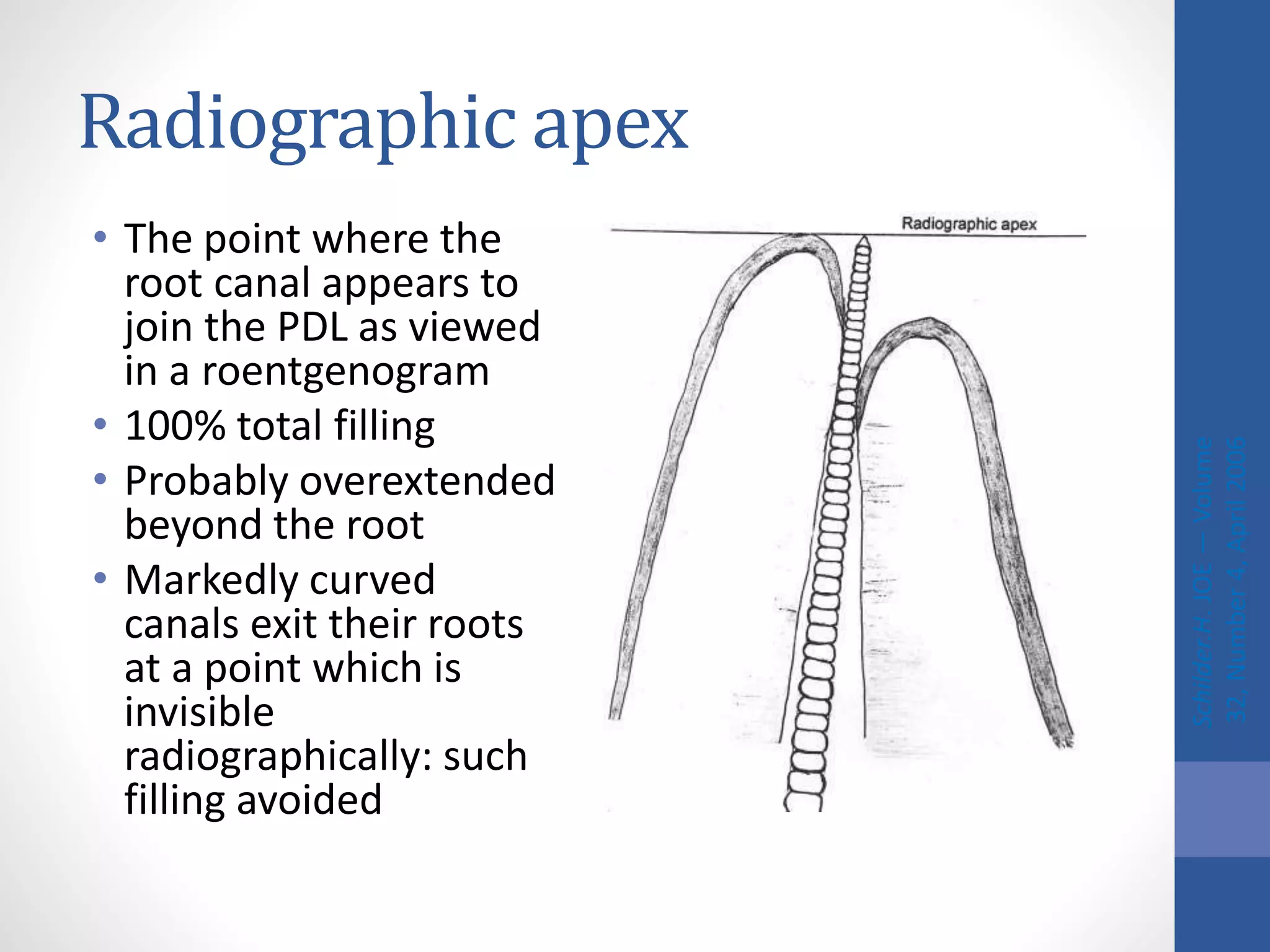 Root Canal Obturation general concepts principles | PPTX