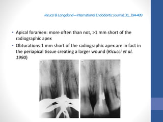Root Canal Obturation general concepts principles | PPTX