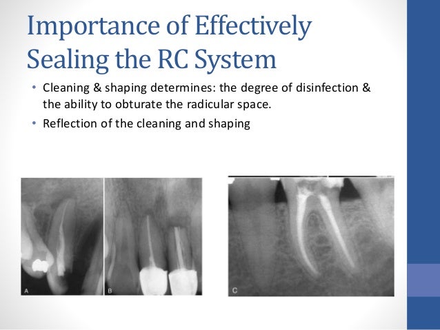 Root Canal Obturation general concepts principles