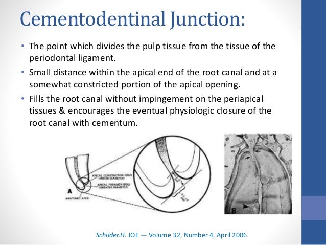 Root Canal Obturation general concepts principles