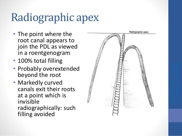Root Canal Obturation general concepts principles