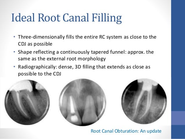 Root Canal Obturation general concepts principles