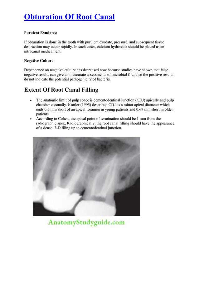 Obturation Of Root Canal Obturation Of Root Canal | PDF | Dental Health | Diseases and Conditions