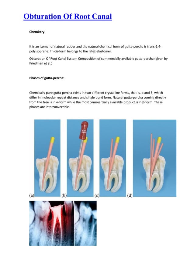 Obturation Of Root Canal Obturation Of Root Canal | PDF | Dental Health | Diseases and Conditions