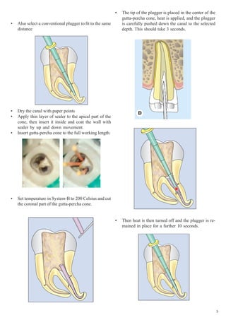 Obturation of Root Canal - An Endodontic Overview | PDF