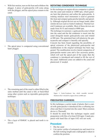 Obturation of Root Canal - An Endodontic Overview | PDF