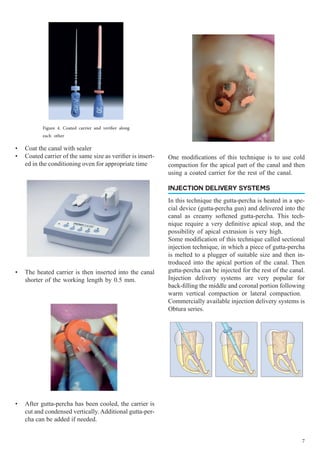 Obturation of Root Canal - An Endodontic Overview | PDF