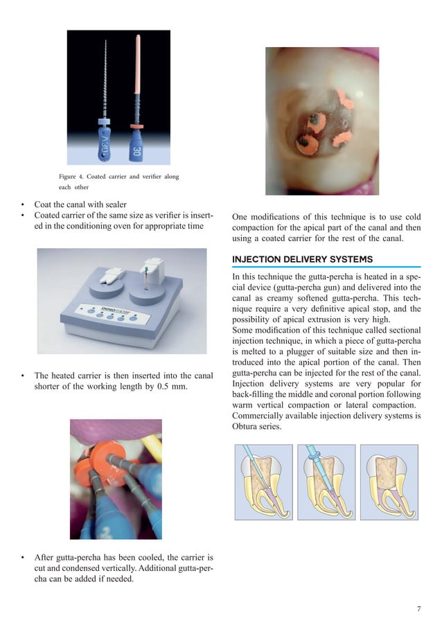 Obturation of Root Canal - An Endodontic Overview | PDF | Dental Health | Diseases and Conditions