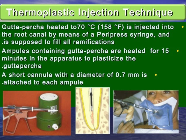 Obturation of root canal system