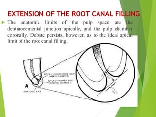 Obturation of root canal system | PPTX