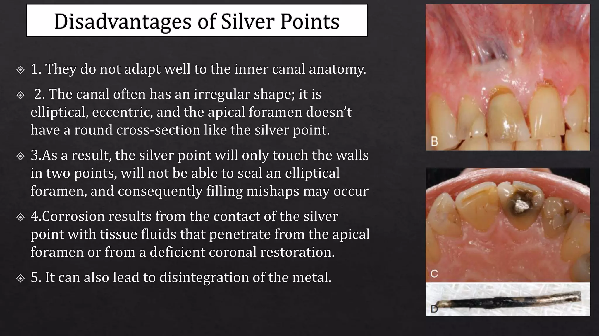 OBTURATION OF ROOT CANAL SYSTEM.pptx