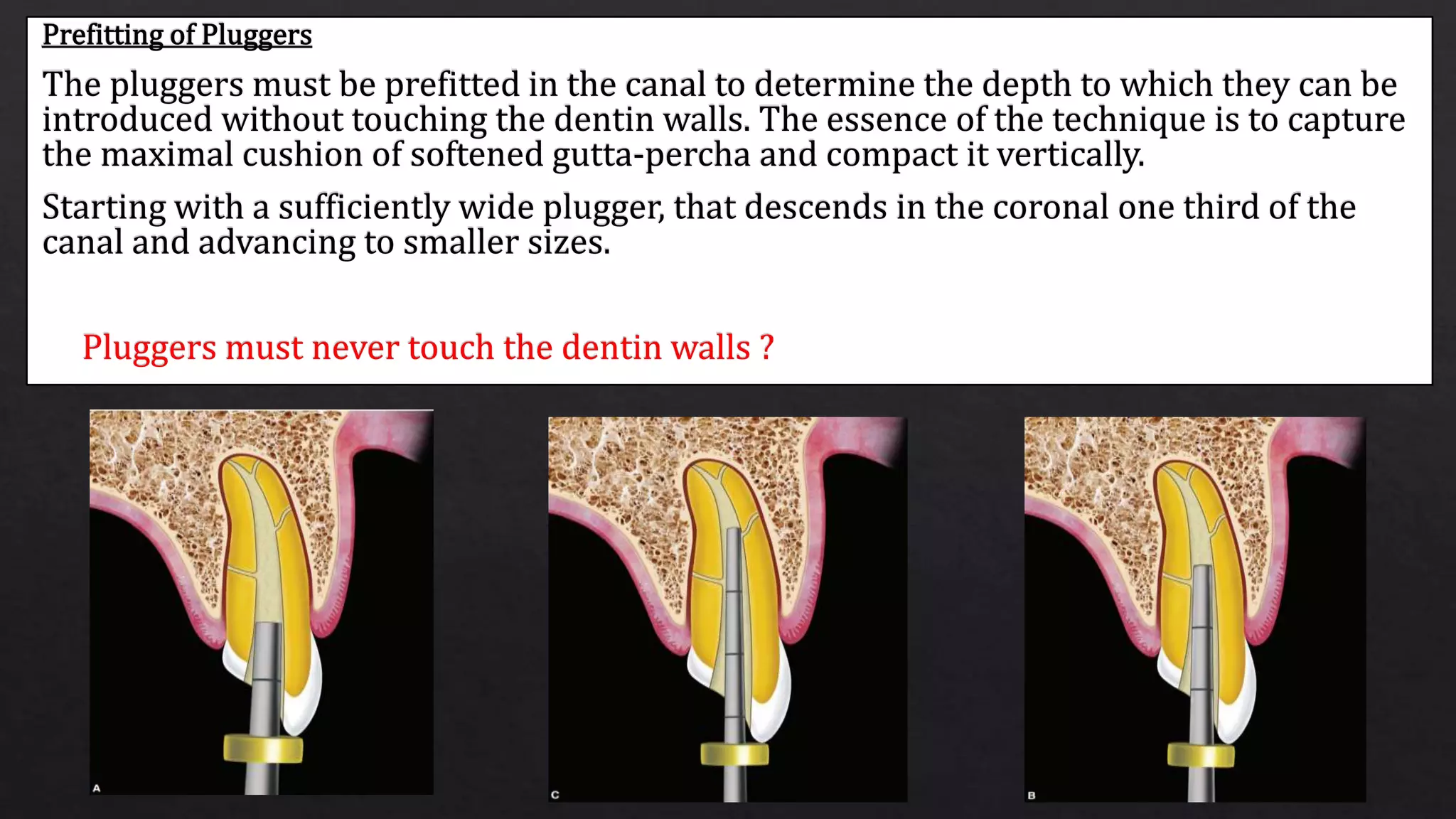 OBTURATION OF ROOT CANAL SYSTEM.pptx