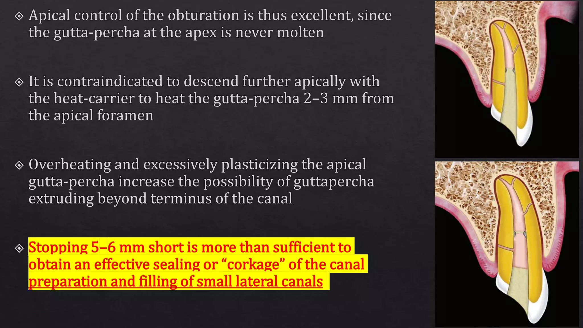 OBTURATION OF ROOT CANAL SYSTEM.pptx