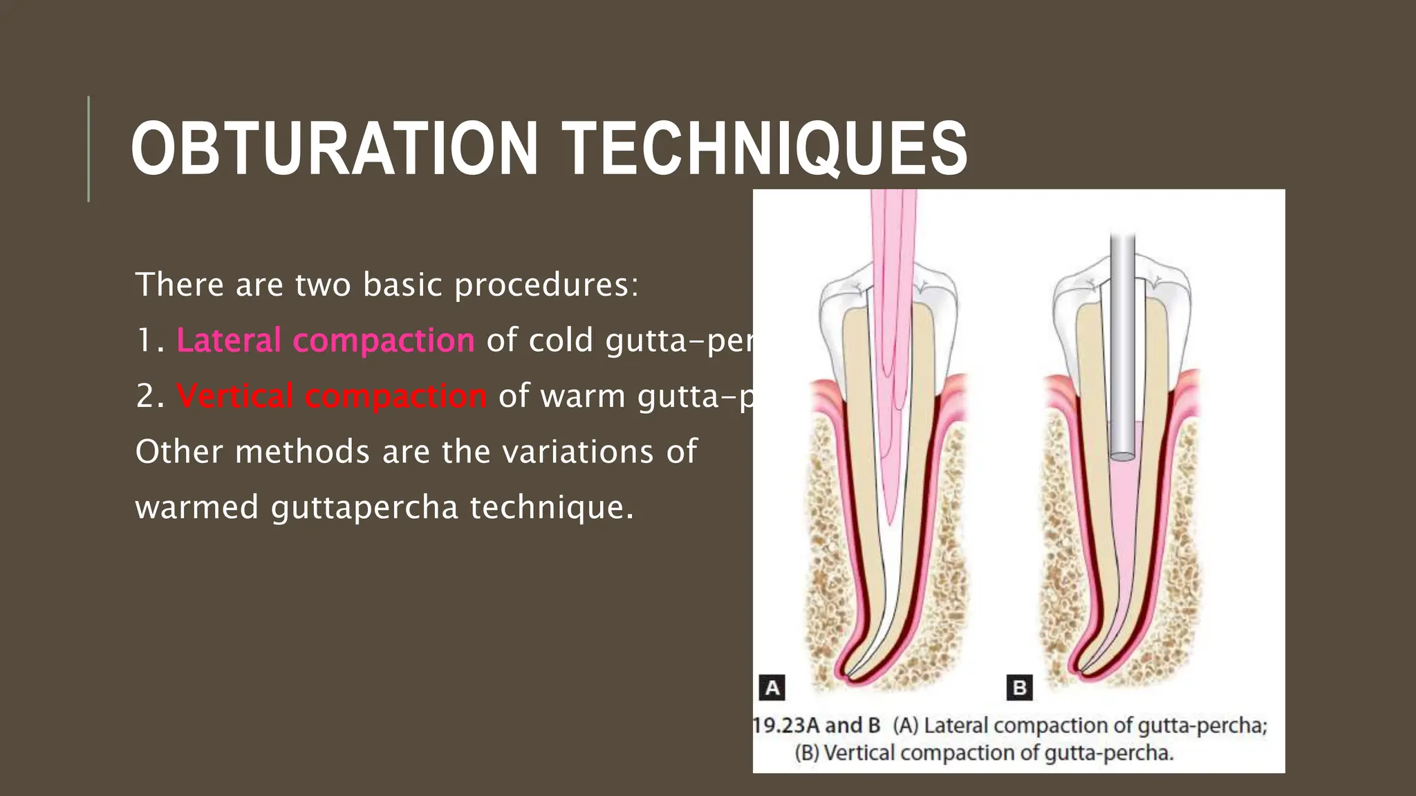 Obturation of Root Canal System. .pptx