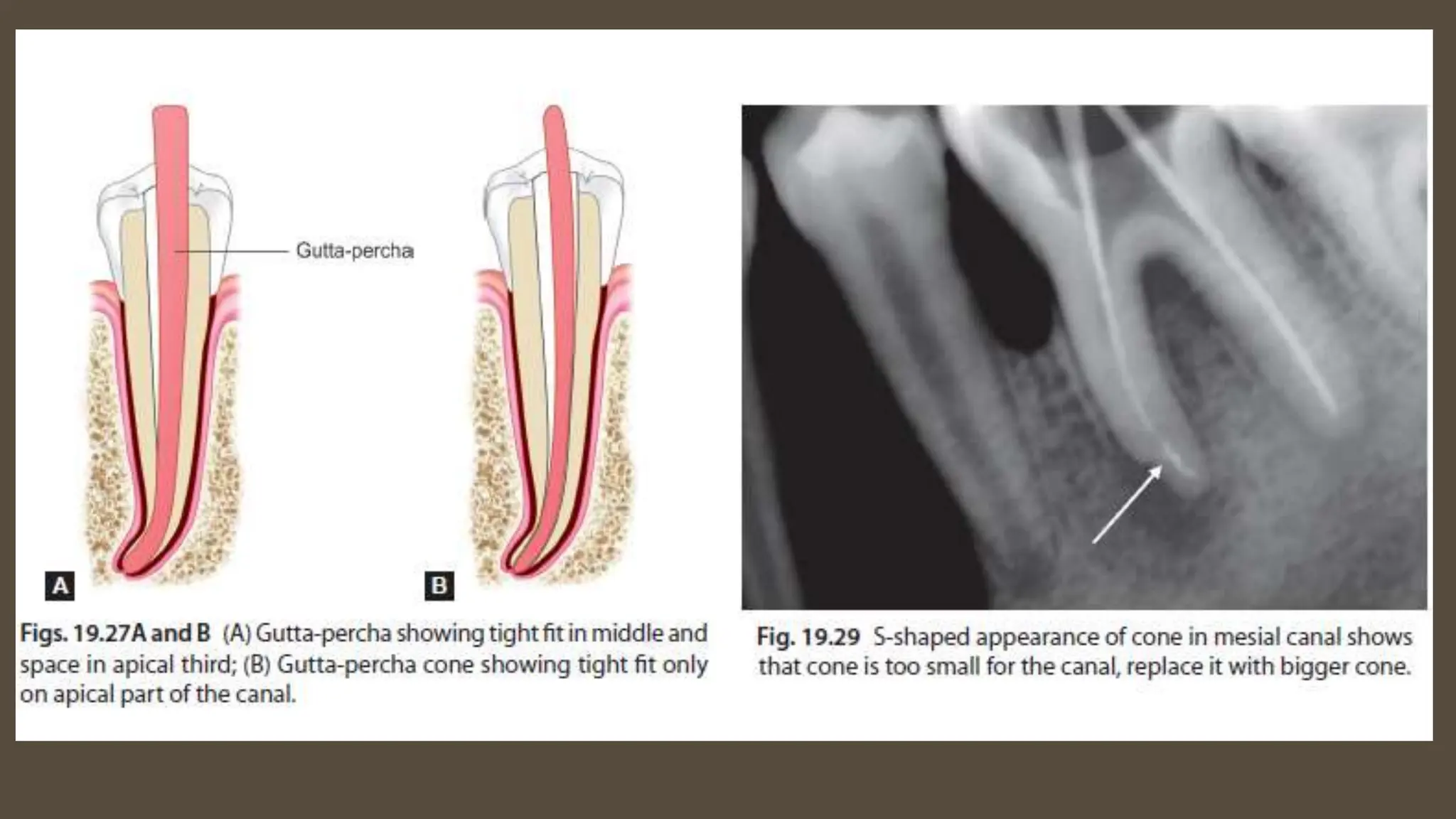 Obturation of Root Canal System. .pptx