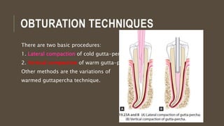 Obturation of Root Canal System. .pptx