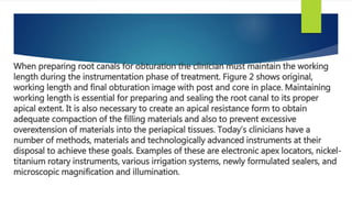 Obturation of root canal systems | PPTX