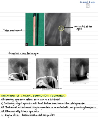 OBTURATION PART 1 (2021 update)- Dr Anshida v p | PDF