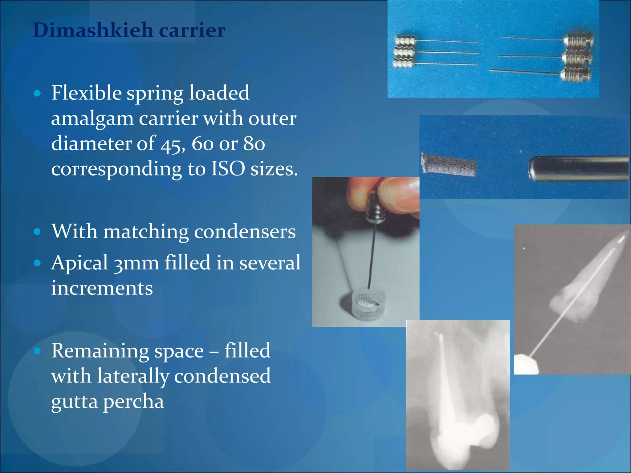 obturation techniques | PPT