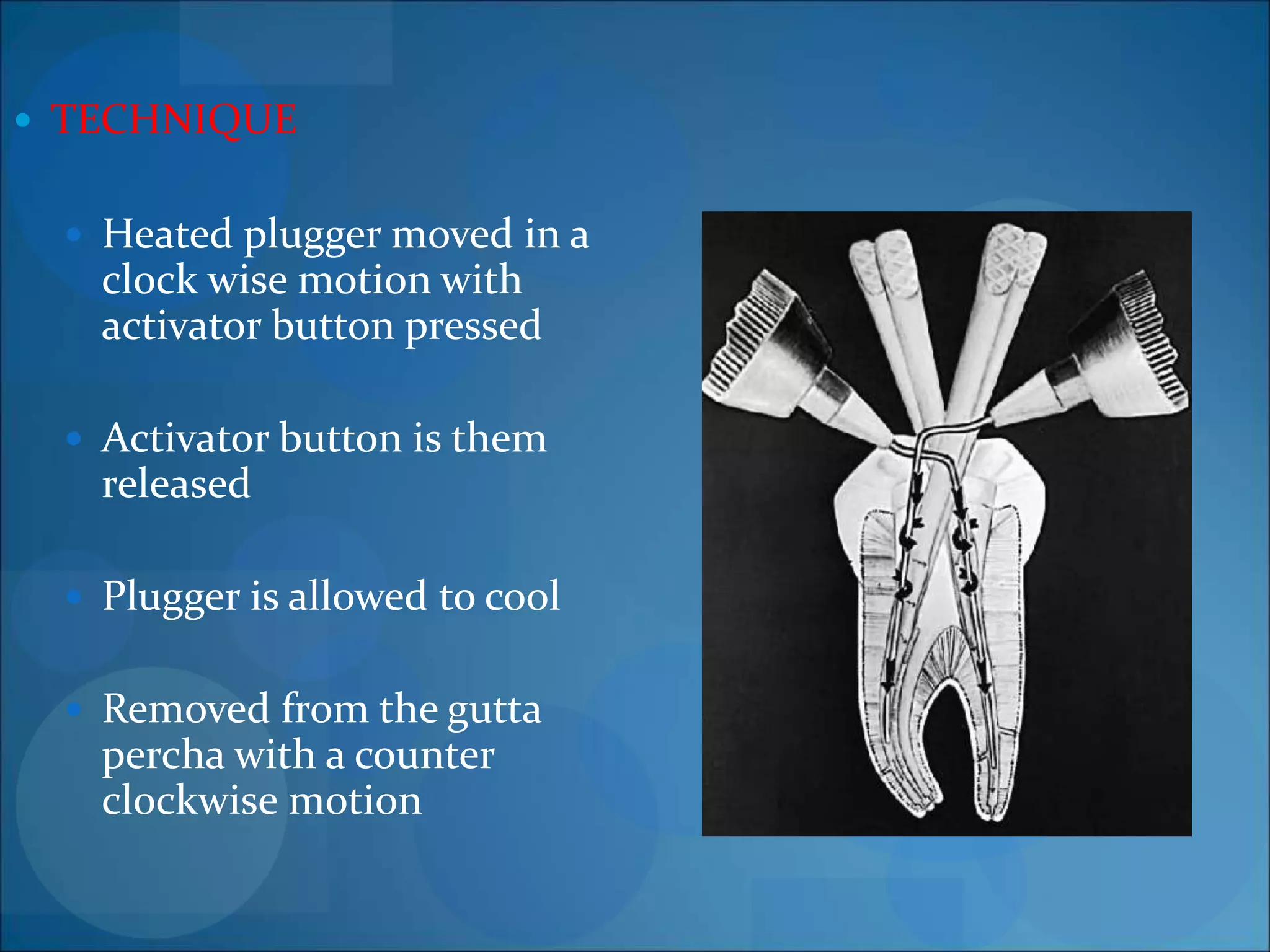 obturation techniques | PPT