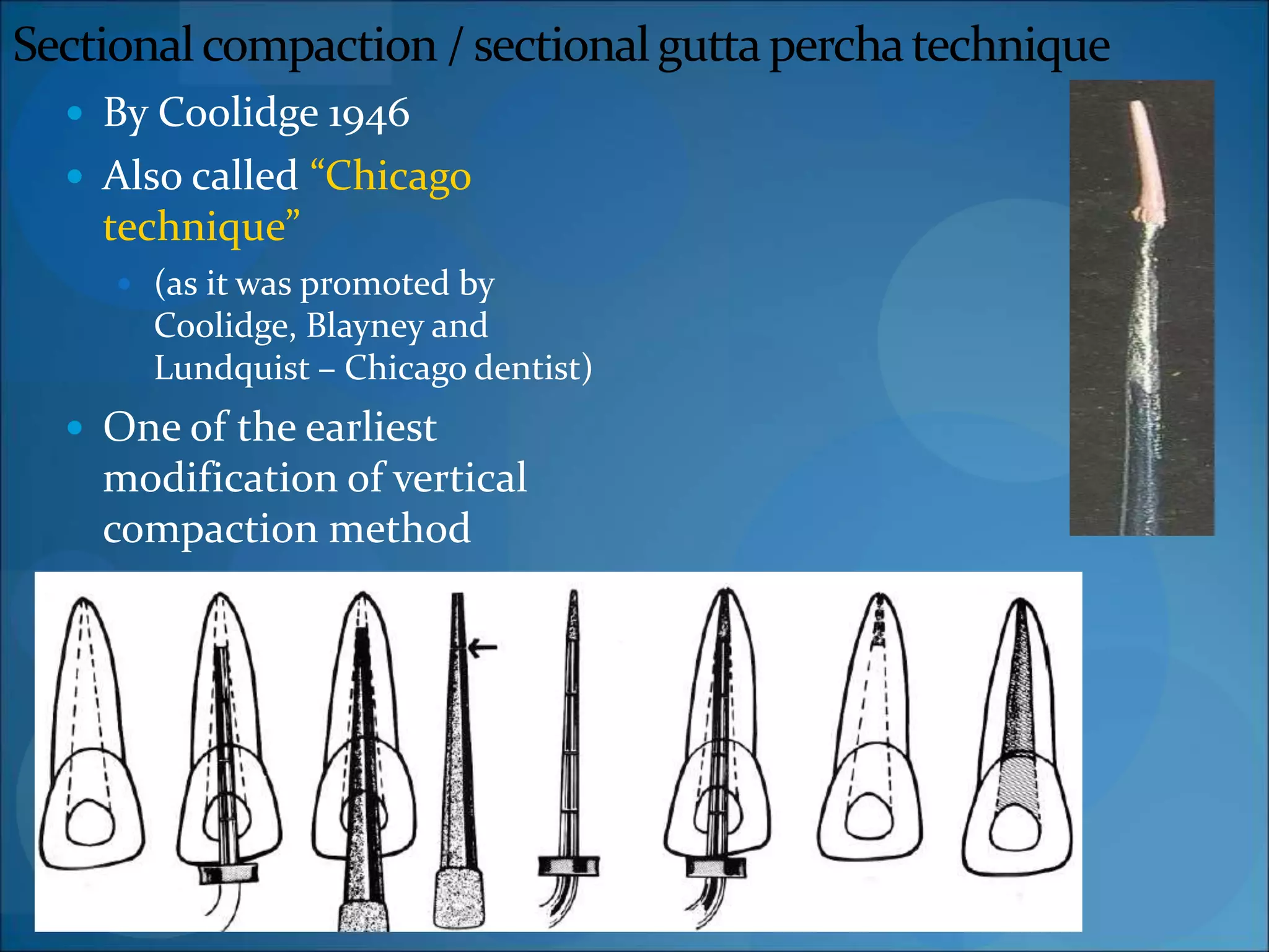 obturation techniques.ppt