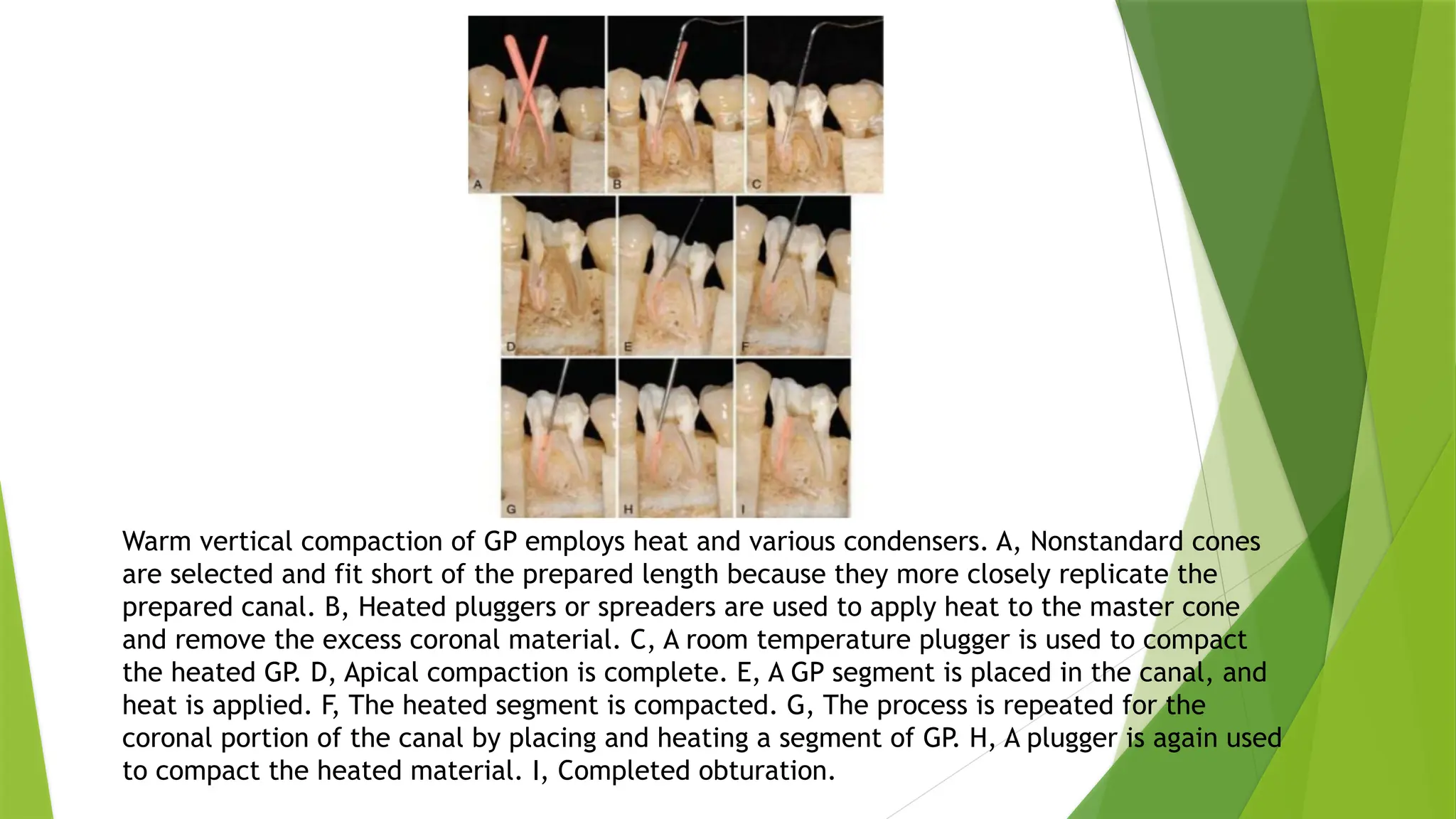 obturation techniques in endodontics.pptx