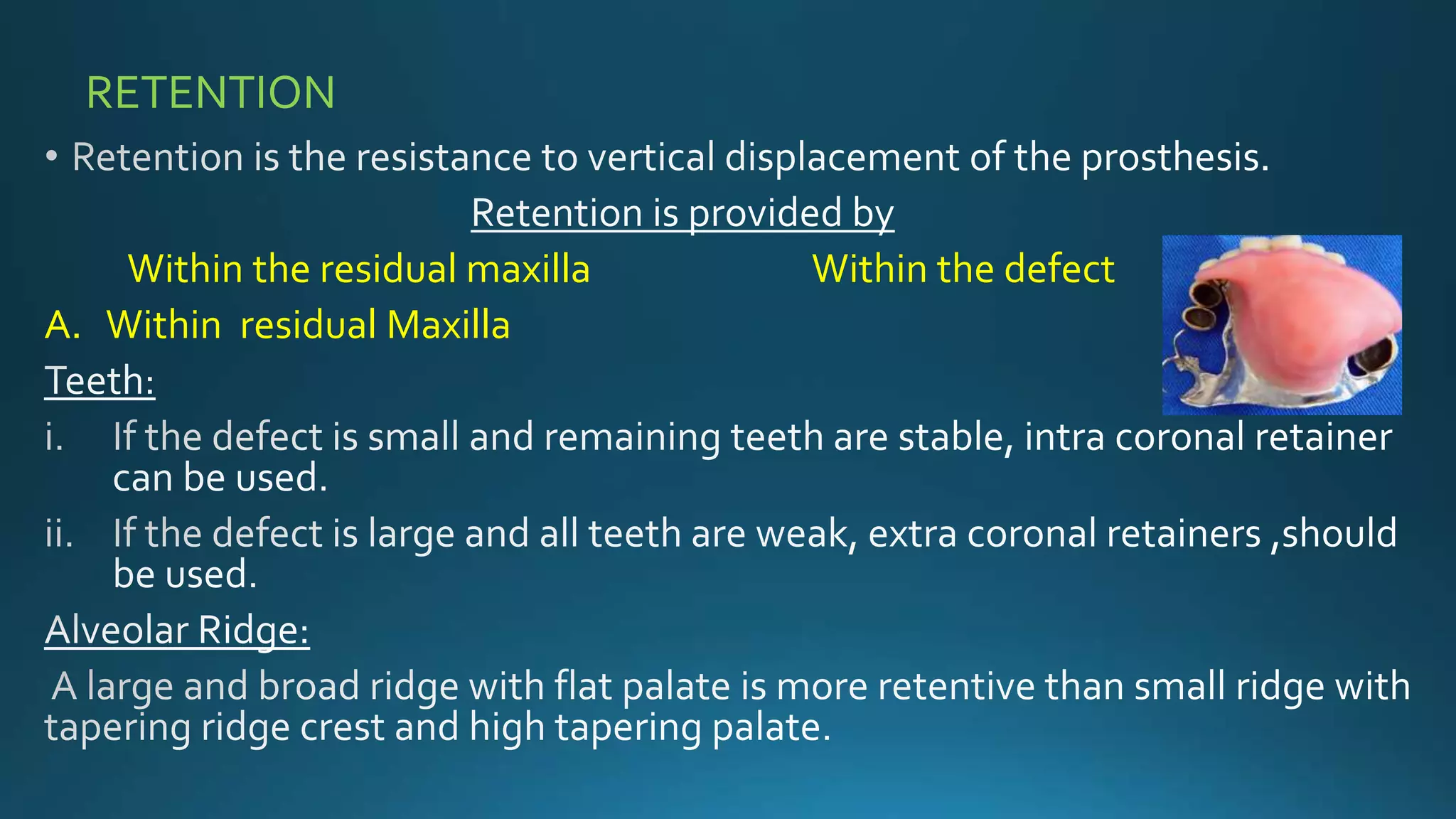 Obturator prosthesis for management of maxillary defects | PPTX