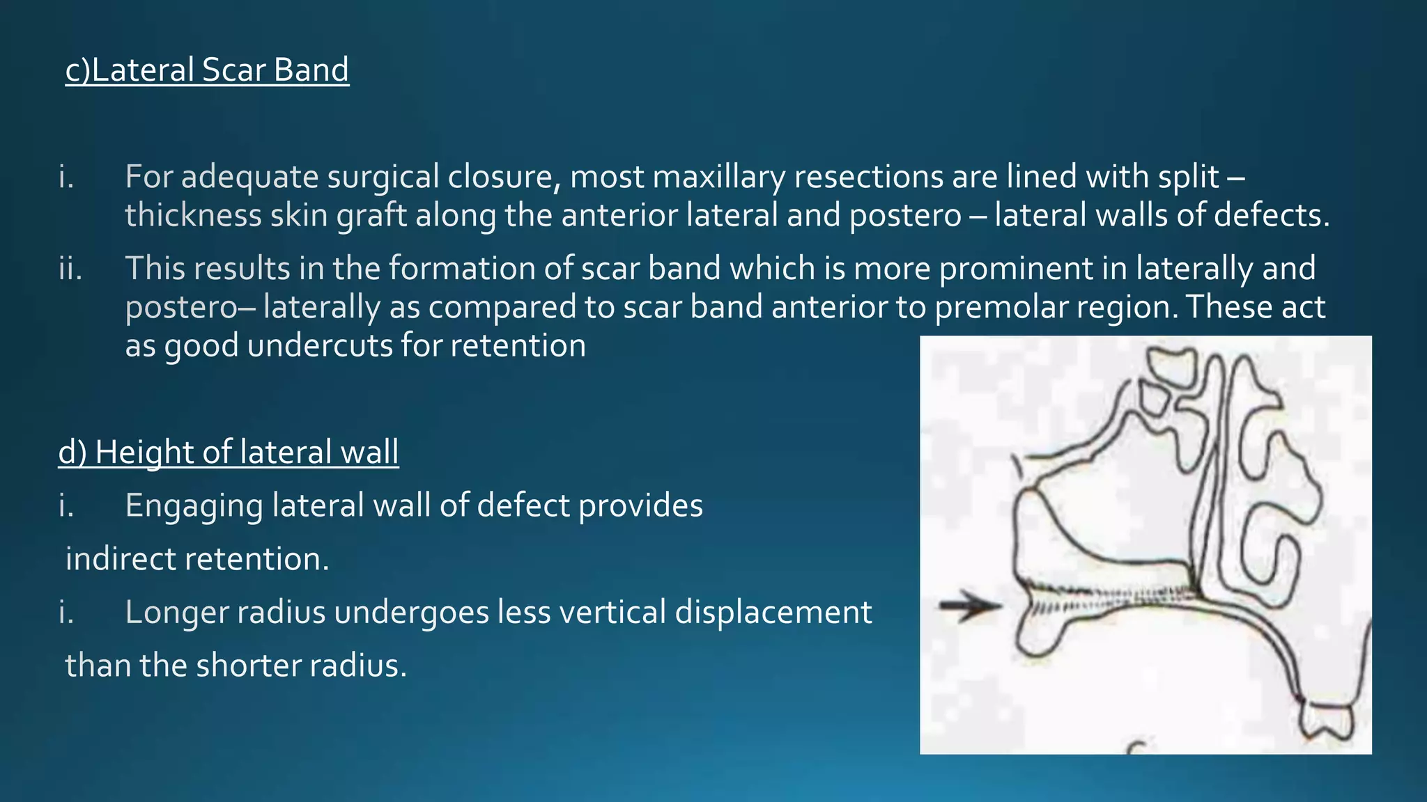Obturator prosthesis for management of maxillary defects | PPTX
