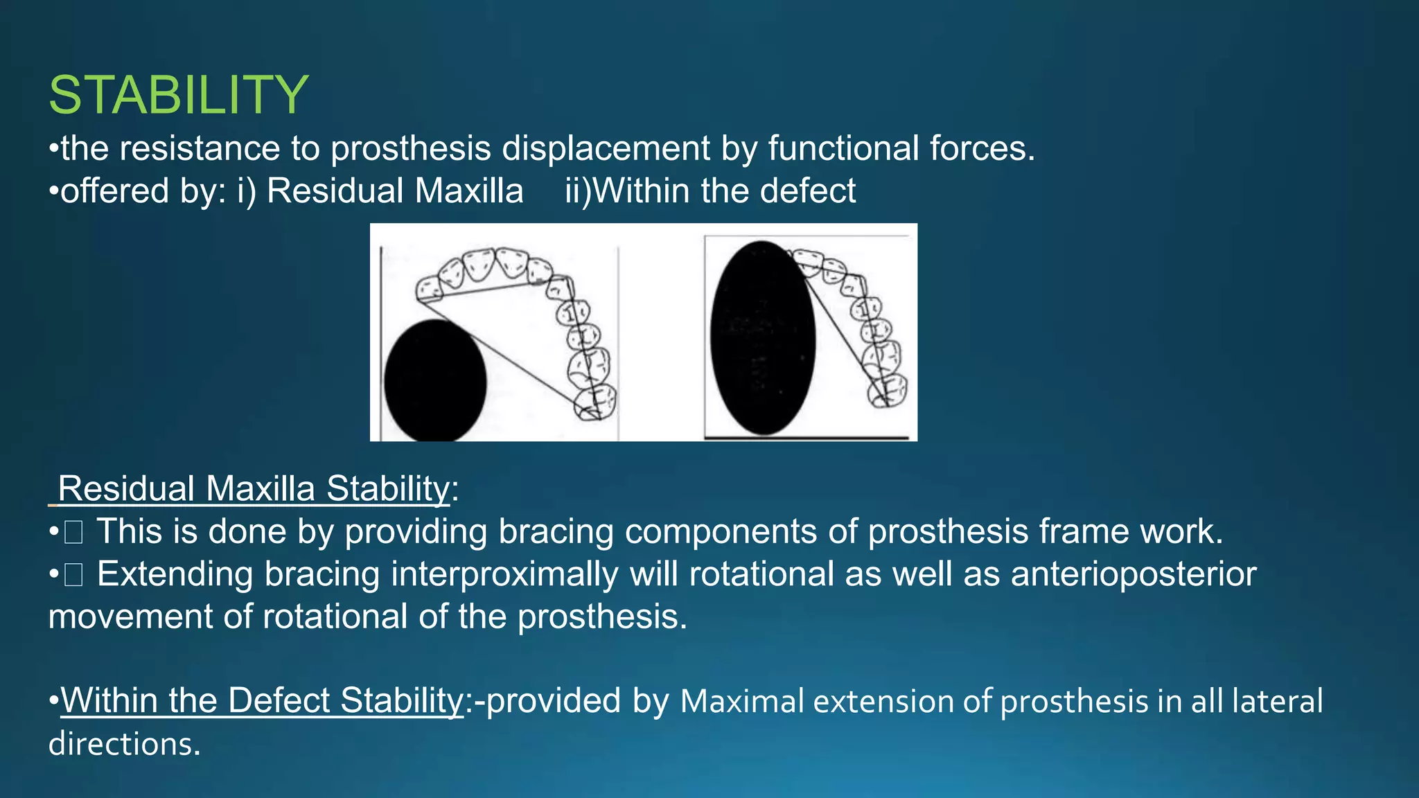 Obturator prosthesis for management of maxillary defects | PPTX