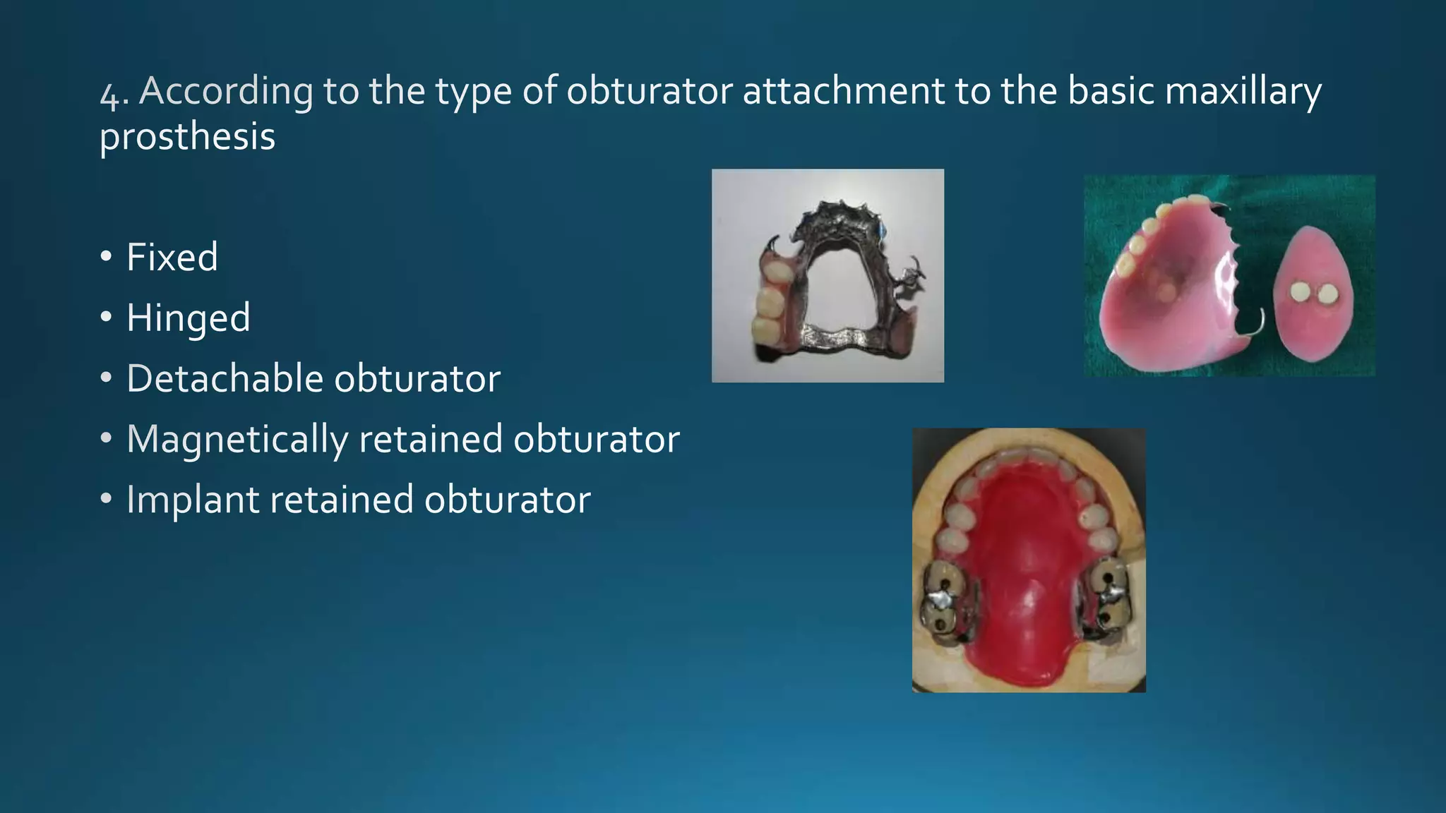 Obturator prosthesis for management of maxillary defects | PPTX