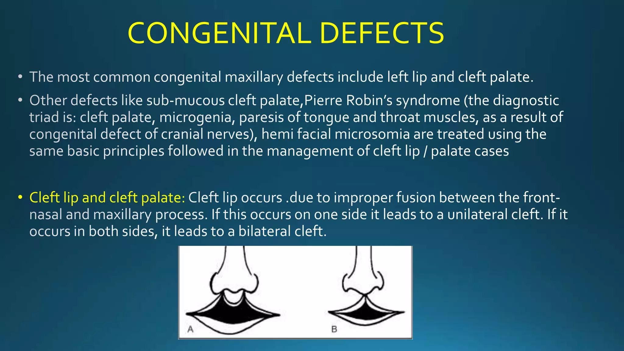 Obturator prosthesis for management of maxillary defects | PPTX
