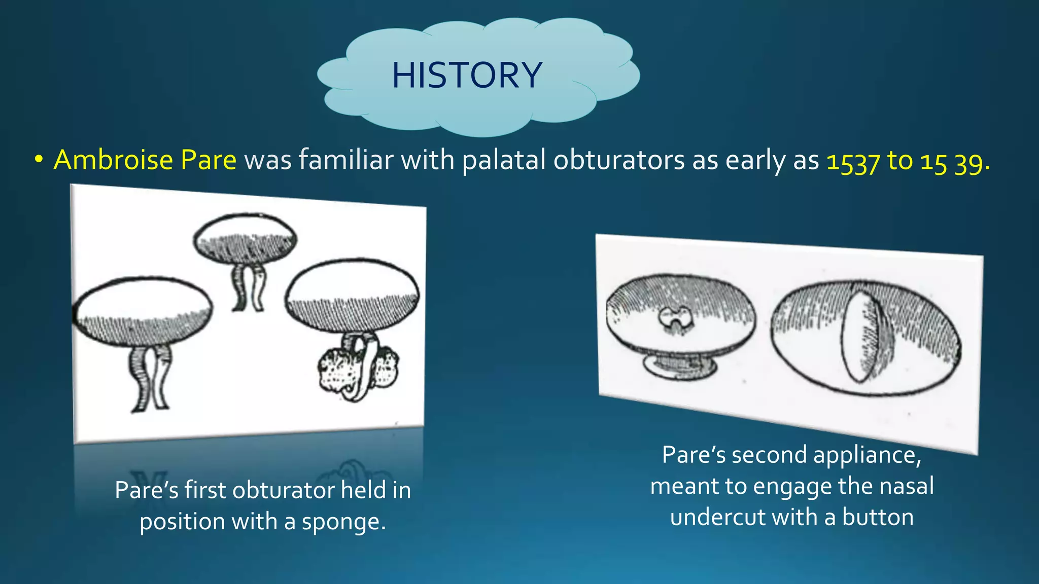 Obturator prosthesis for management of maxillary defects | PPTX