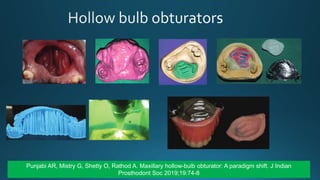 Obturator prosthesis for management of maxillary defects | PPTX