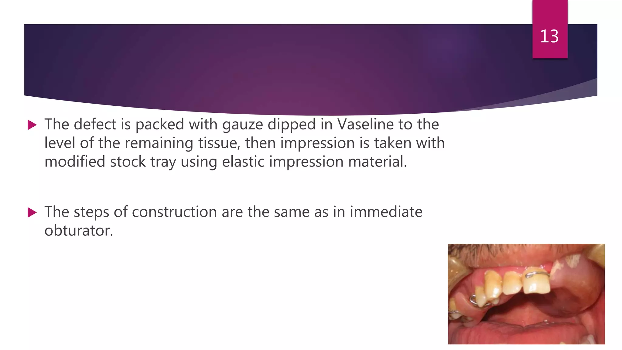 Obturator ppt | PPTX