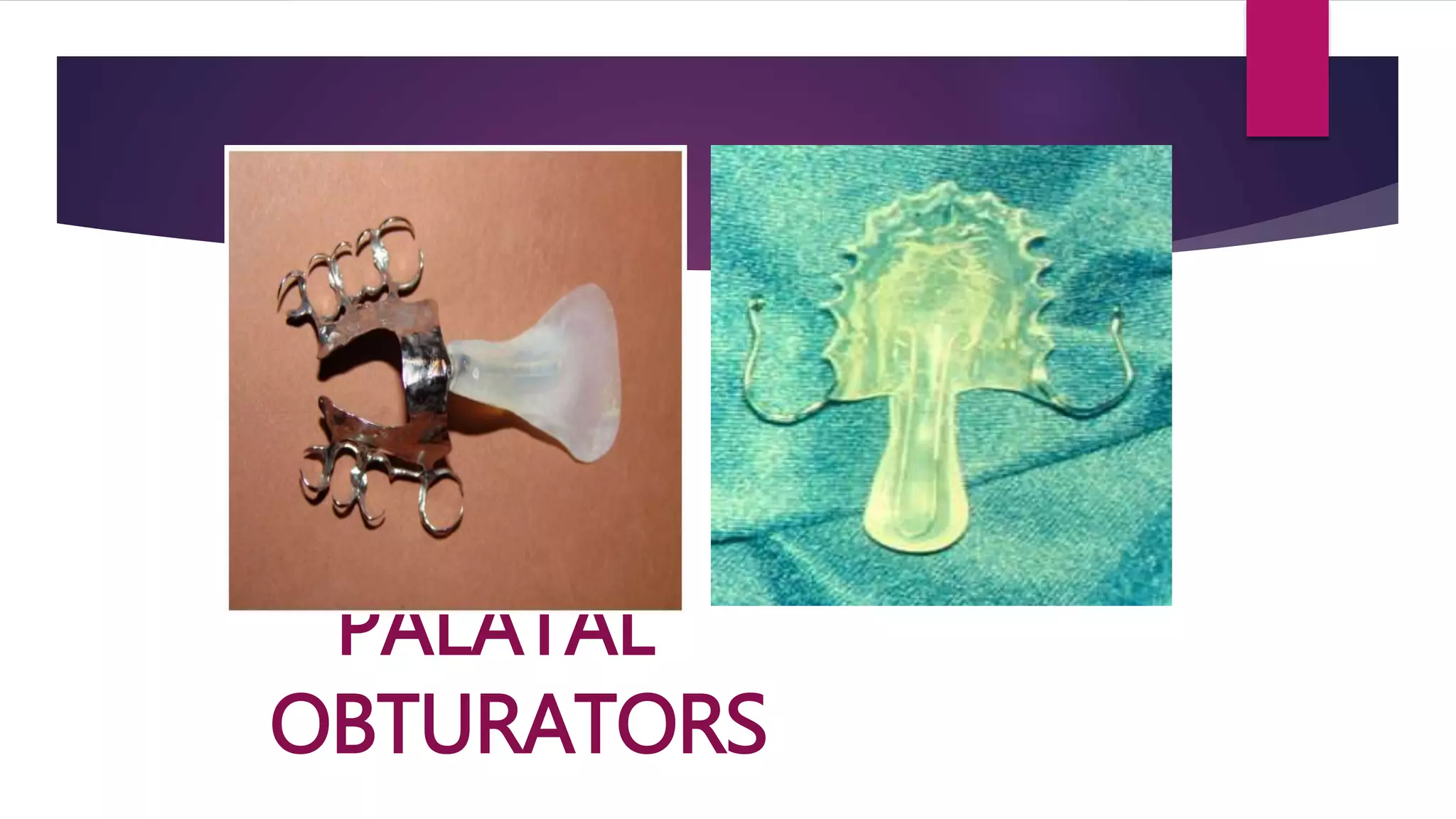 Obturator ppt | PPTX