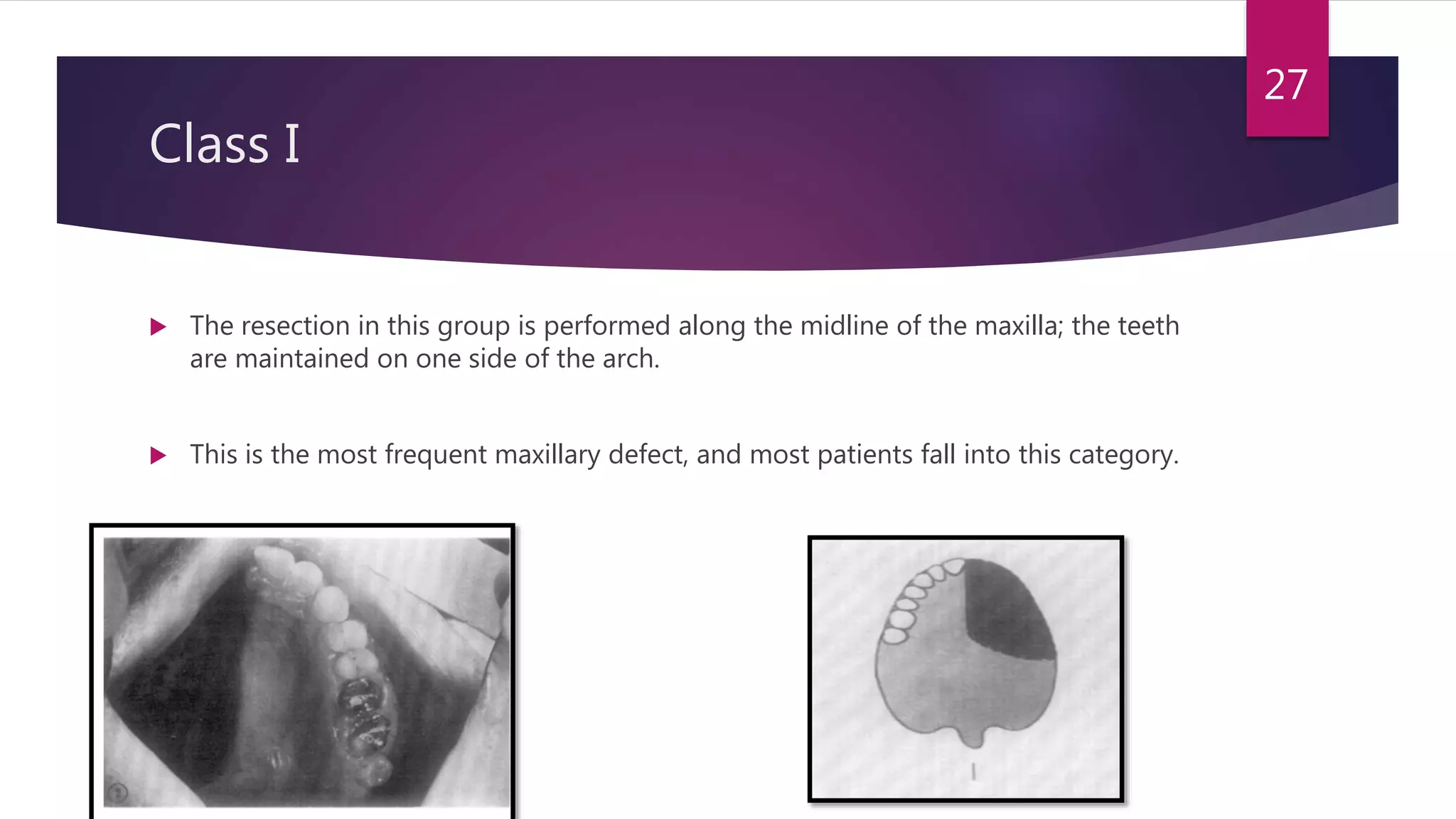 Obturator ppt | PPTX
