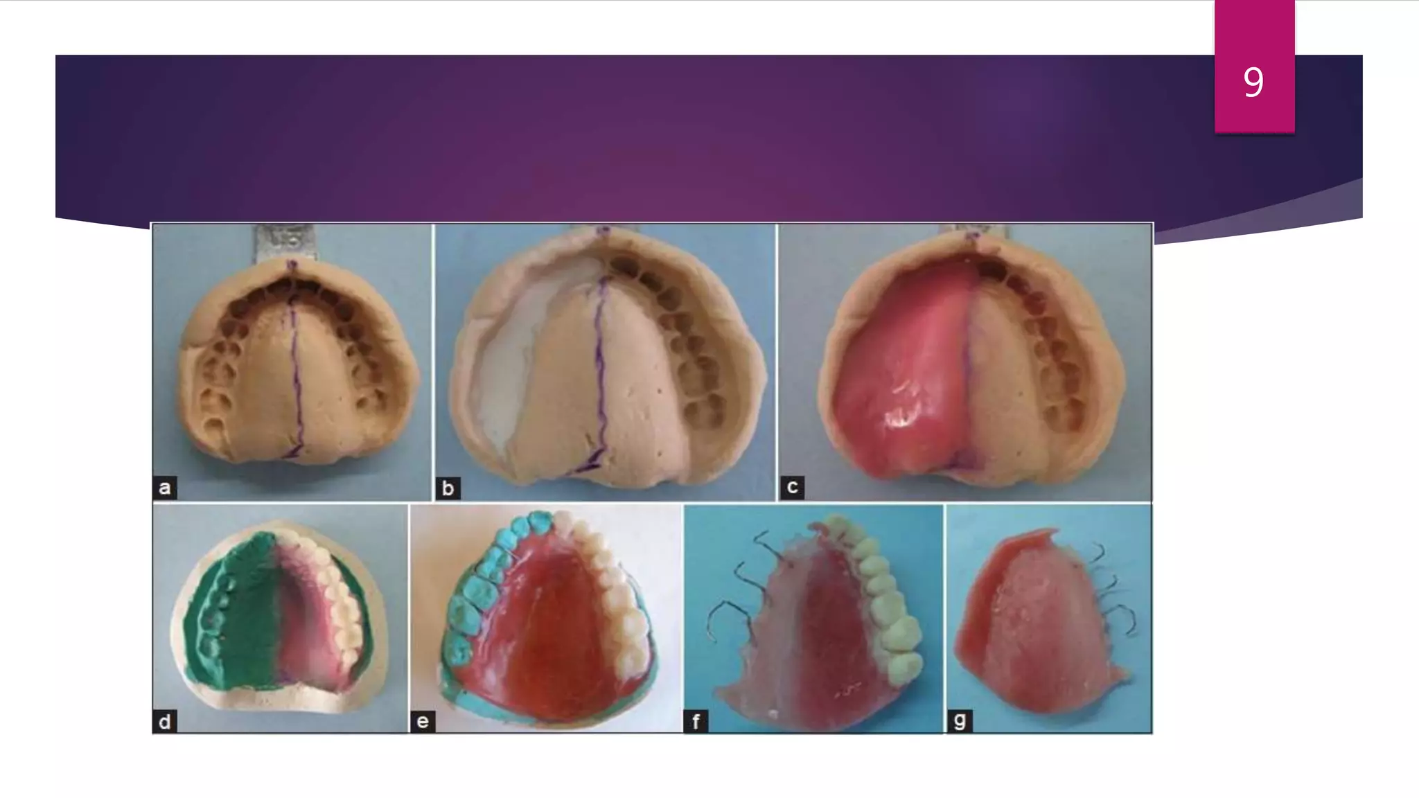 Obturator ppt | PPTX