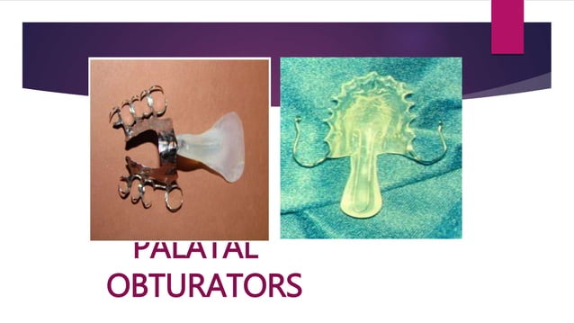 Obturator ppt | PPTX