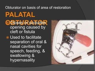 Obturators | PPTX