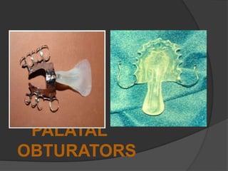 Obturators | PPTX